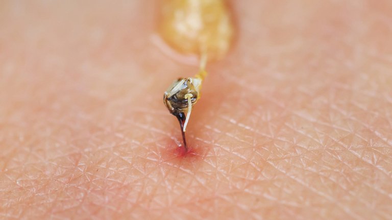 How Do You Treat An Insect Sting While Camping?